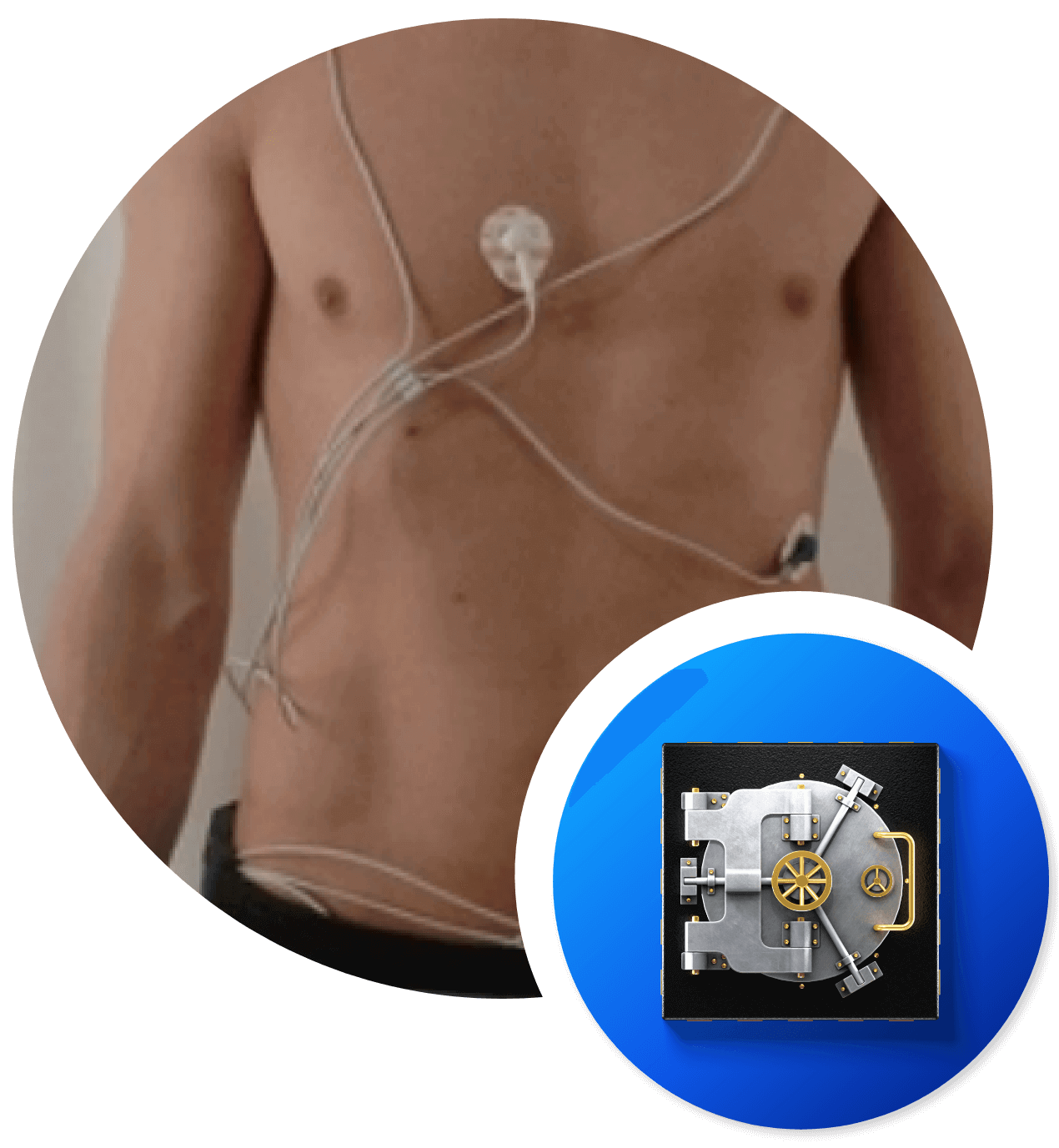 Rethinking Epilepsy Management with a Portable Medical Device - Silicon ...