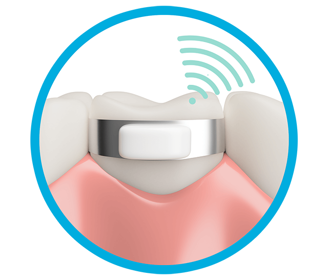 Small Bluetooth Chip Powers Lura's Oral Health Monitor - Silicon Labs