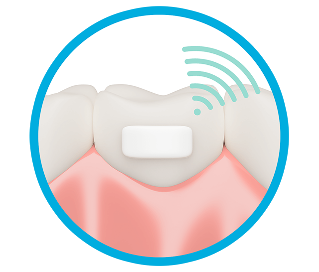 Small Bluetooth Chip Powers Lura's Oral Health Monitor - Silicon Labs